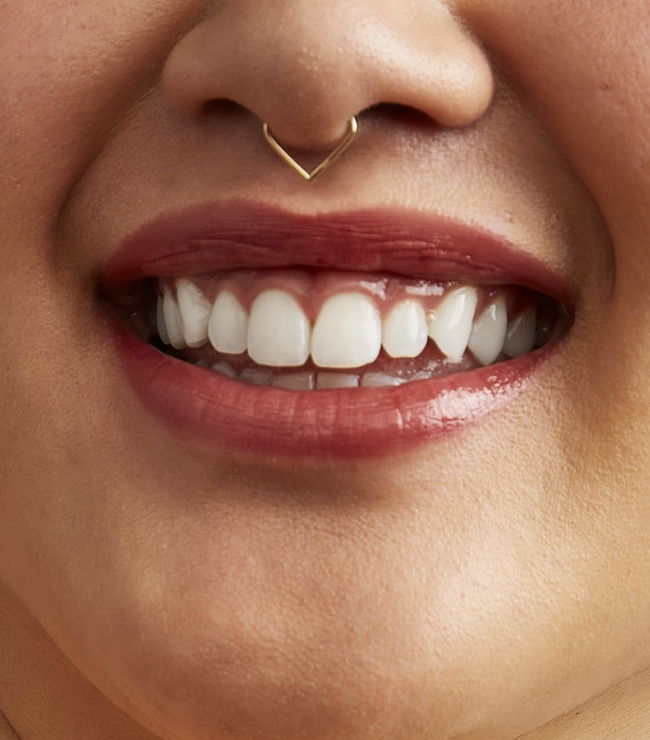 Classics | Banter | Banter